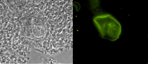 Tackling AMR in Wastewater Systems with Sneaky Bacteria | GrahAM ...