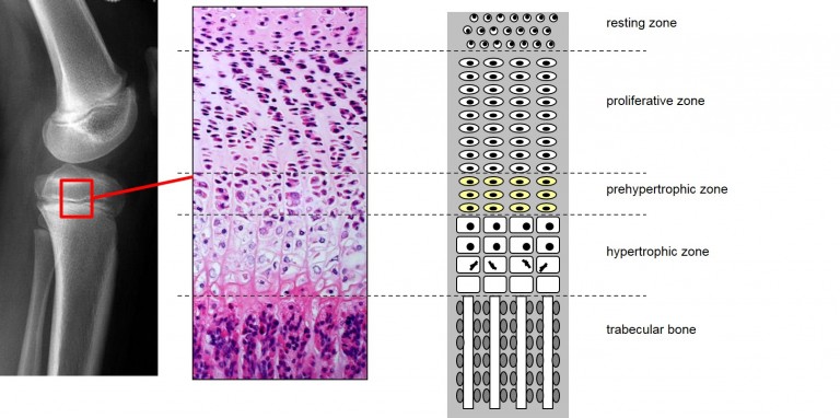 How Do Long Bones Grow Musculoskeletal Genetics