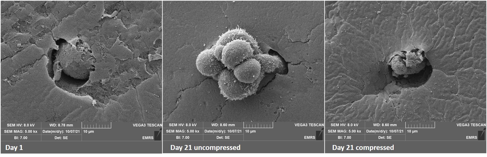 First SEM images of ATDC5 cells embedded in agar – Musculoskeletal Genetics